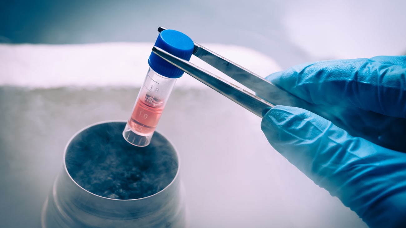 another-promising-application-for-stem-cells-crohn-s-complications