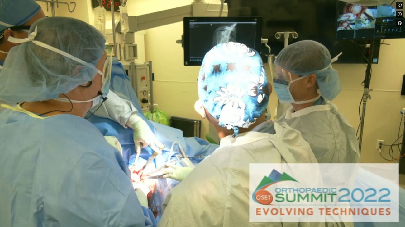 Total Shoulder Arthroplasty with a Nonspherical Humeral Implant and an Inlay Glenoid - Baptist ...