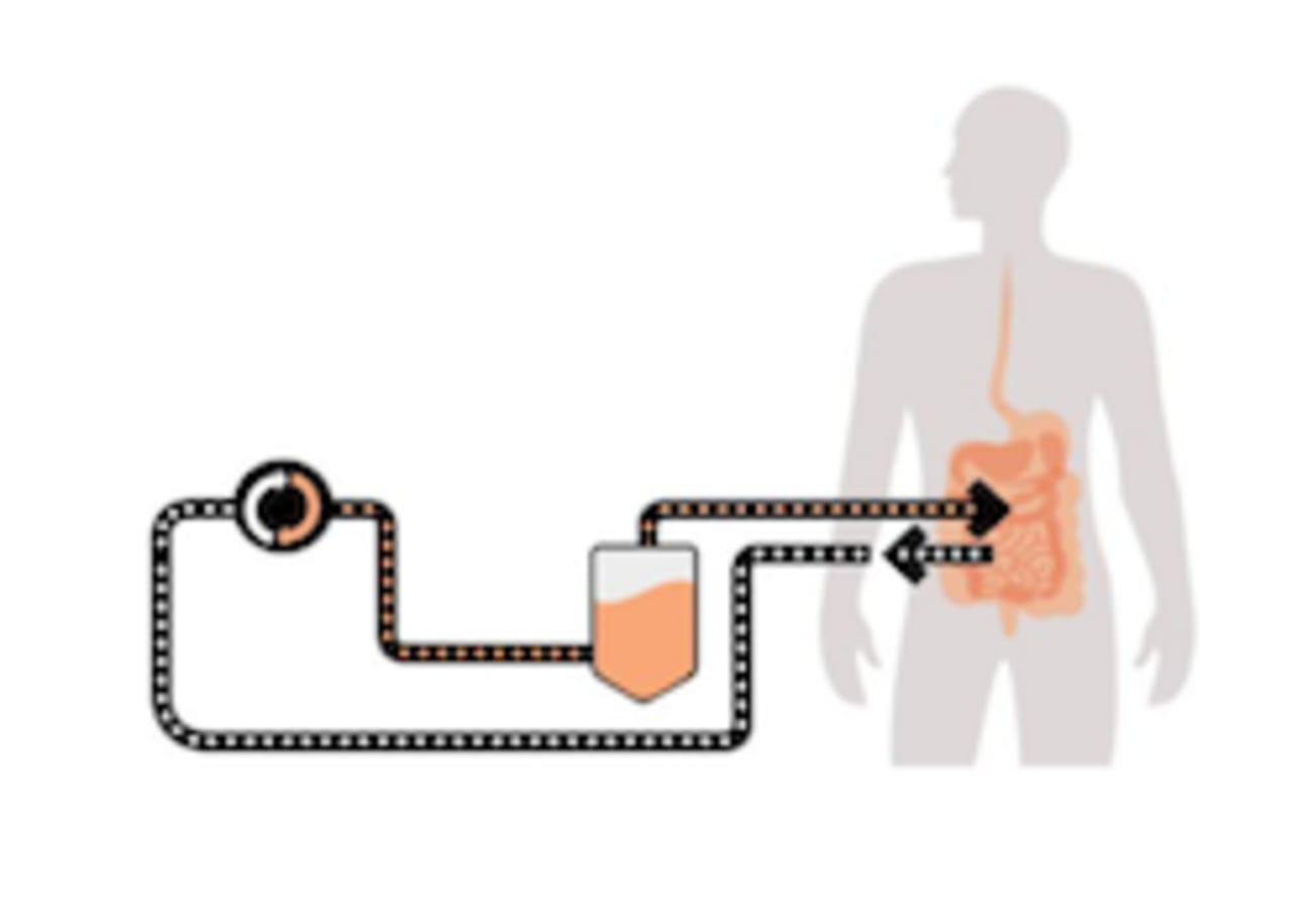 More Effective Treatment Of Peritoneal Tumors Johns Hopkins Medicine