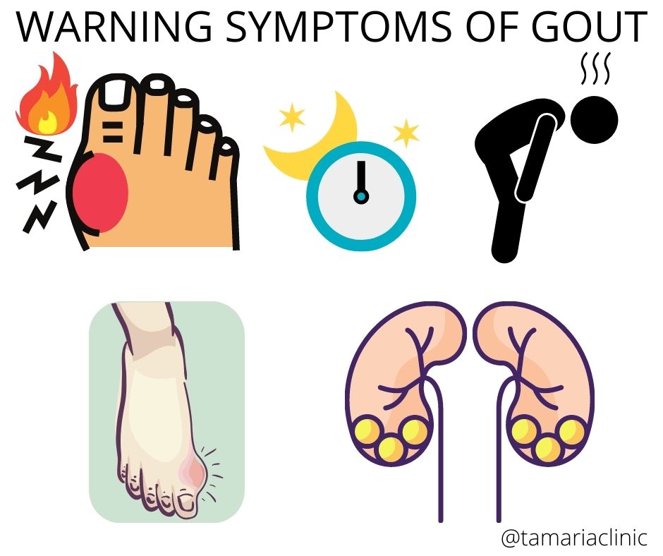 7 Warning Signs To Look For Gout