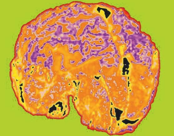 Hierarchical Segmentation Enhances Diagnostic Imaging Tech Briefs 5510