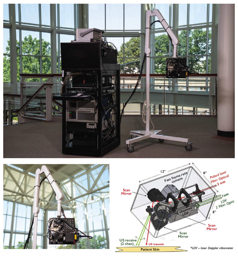 Laser Based System Achieves Noncontact Medical Ultrasound Imaging