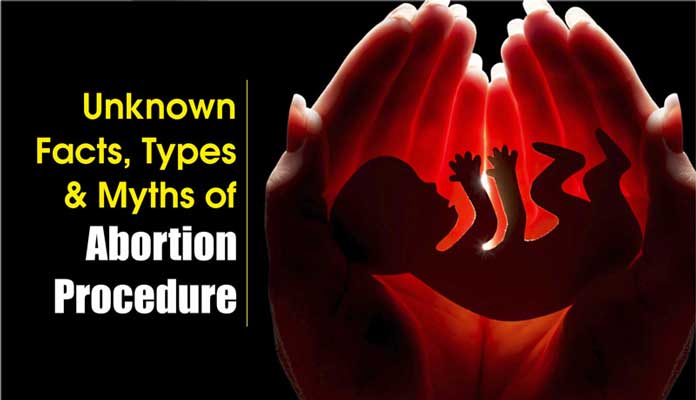 Unknown Facts, Types, and Myths of Abortion Procedure - Aaj Ki Naari