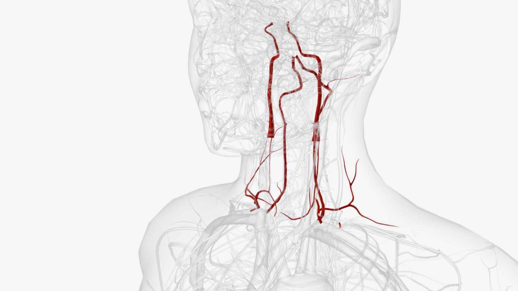 carotid artery dysfunction