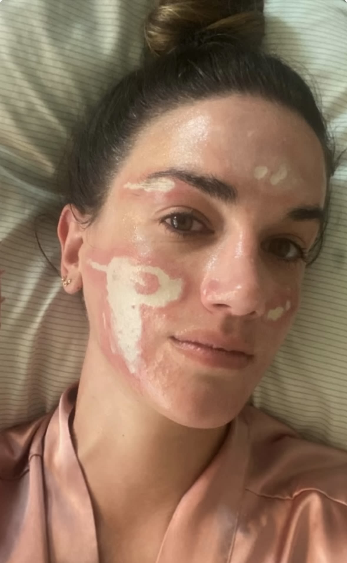 Botched Beauty: How to Protect Yourself and Respond If a Treatment ...