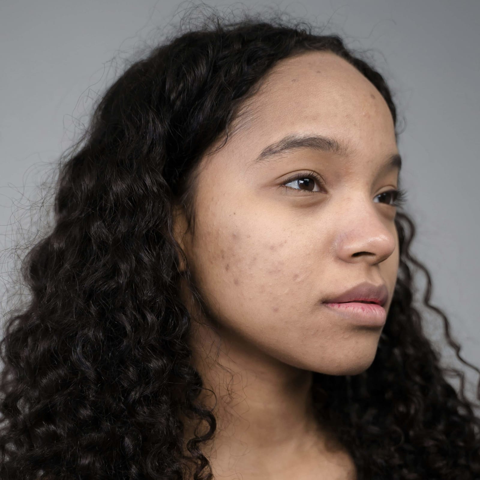 LaseMD Ultra Explained: Is This Medspa Treatment Worth the Investment ...