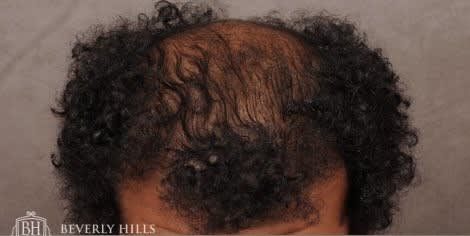 Ben Talei, MD - facial plastic and reconstructive surgery provider in ...