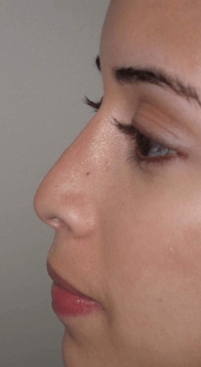 David Abramson, MD, FACS - plastic and reconstructive surgery provider ...