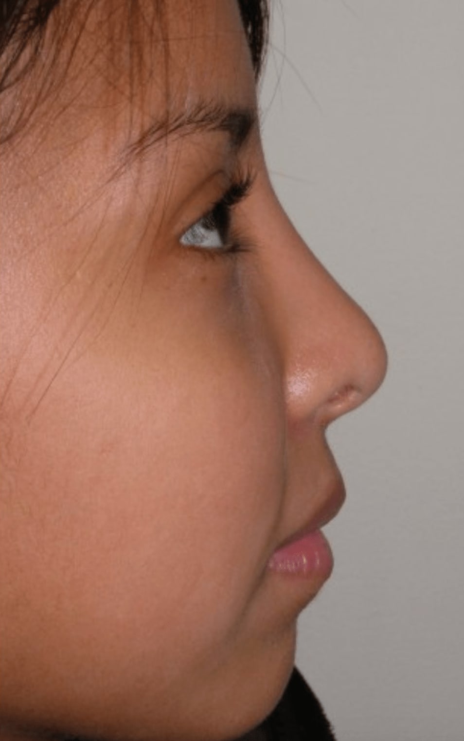 David Abramson, MD, FACS - plastic and reconstructive surgery provider ...