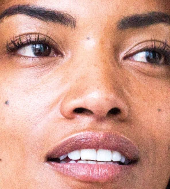 Lip Augmentation Solutions Overview: Cost, Recovery, Before & After | AEDIT