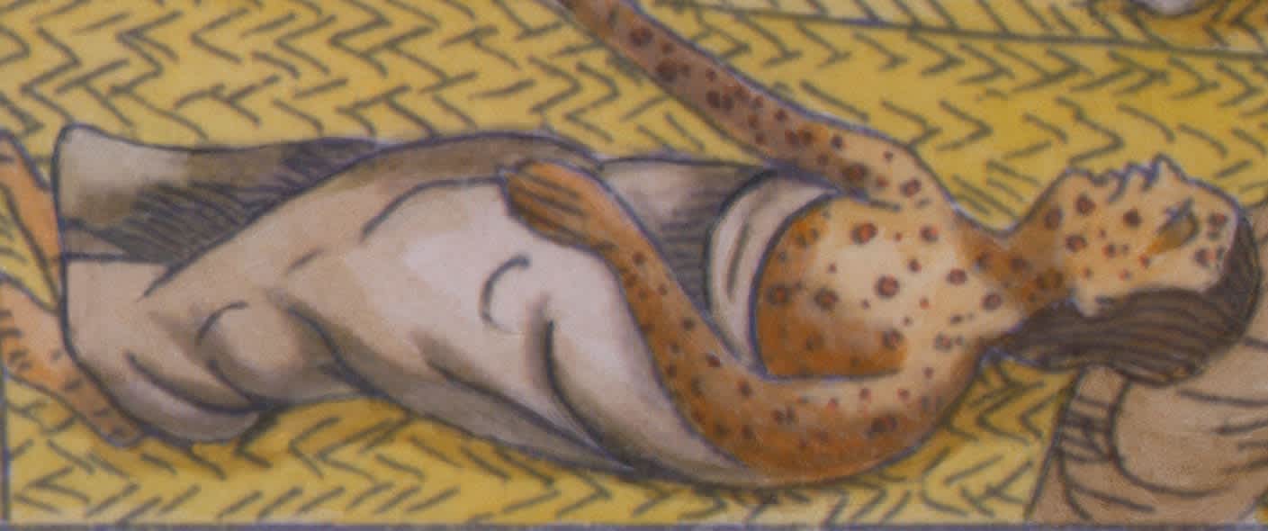 Did Colonists Give Infected Blankets to Native Americans as Biological ...