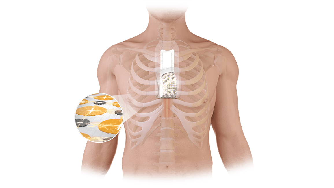 Arthrex - Cardiothoracic Surgery