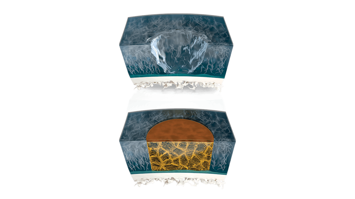 Arthrex - Orthobiologics