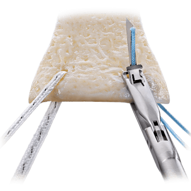 Arthrex - Orthobiologics