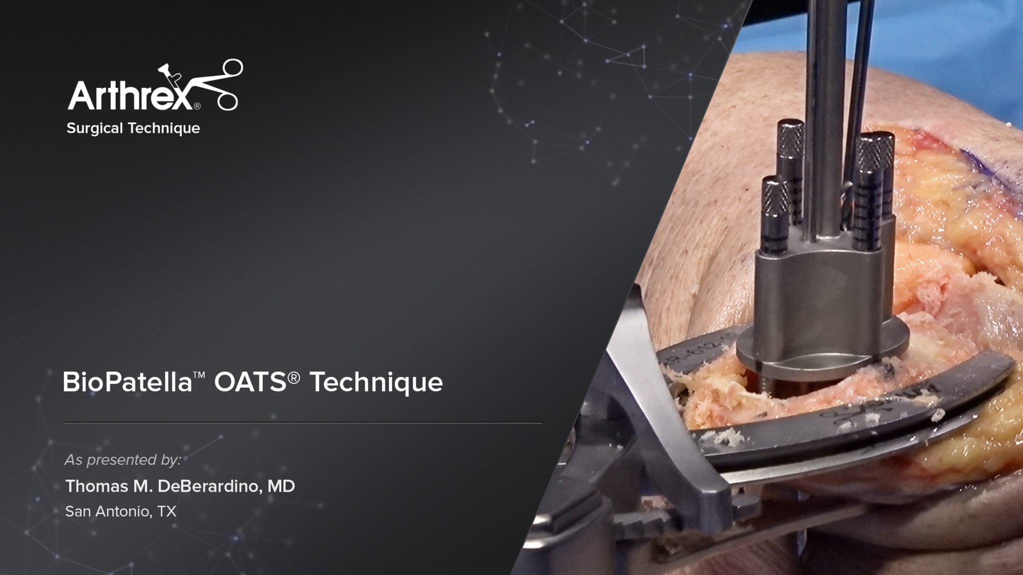 Arthrex - BioPatella™ OATS® Instrument Set