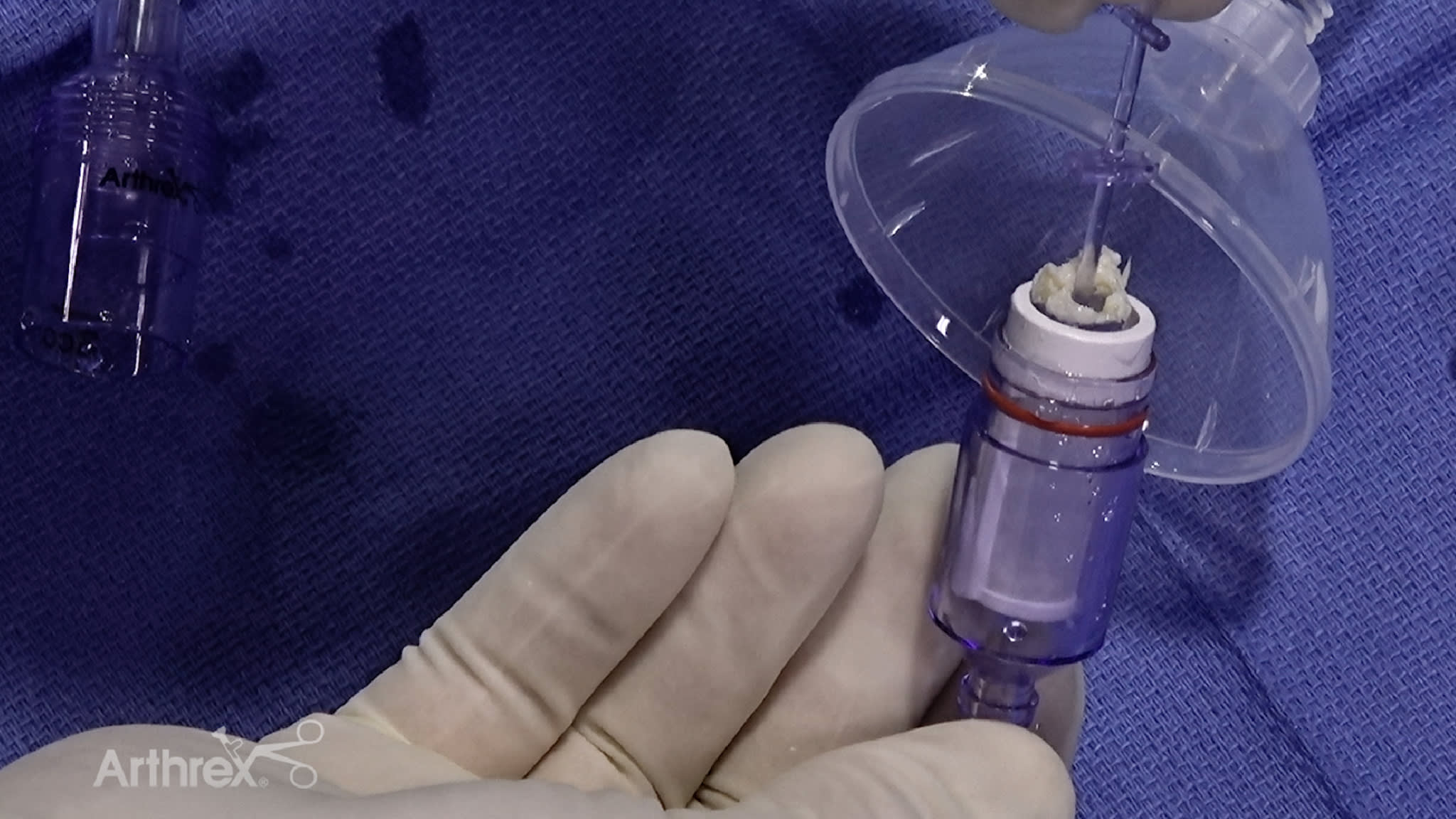 Arthrex - AutoCart™