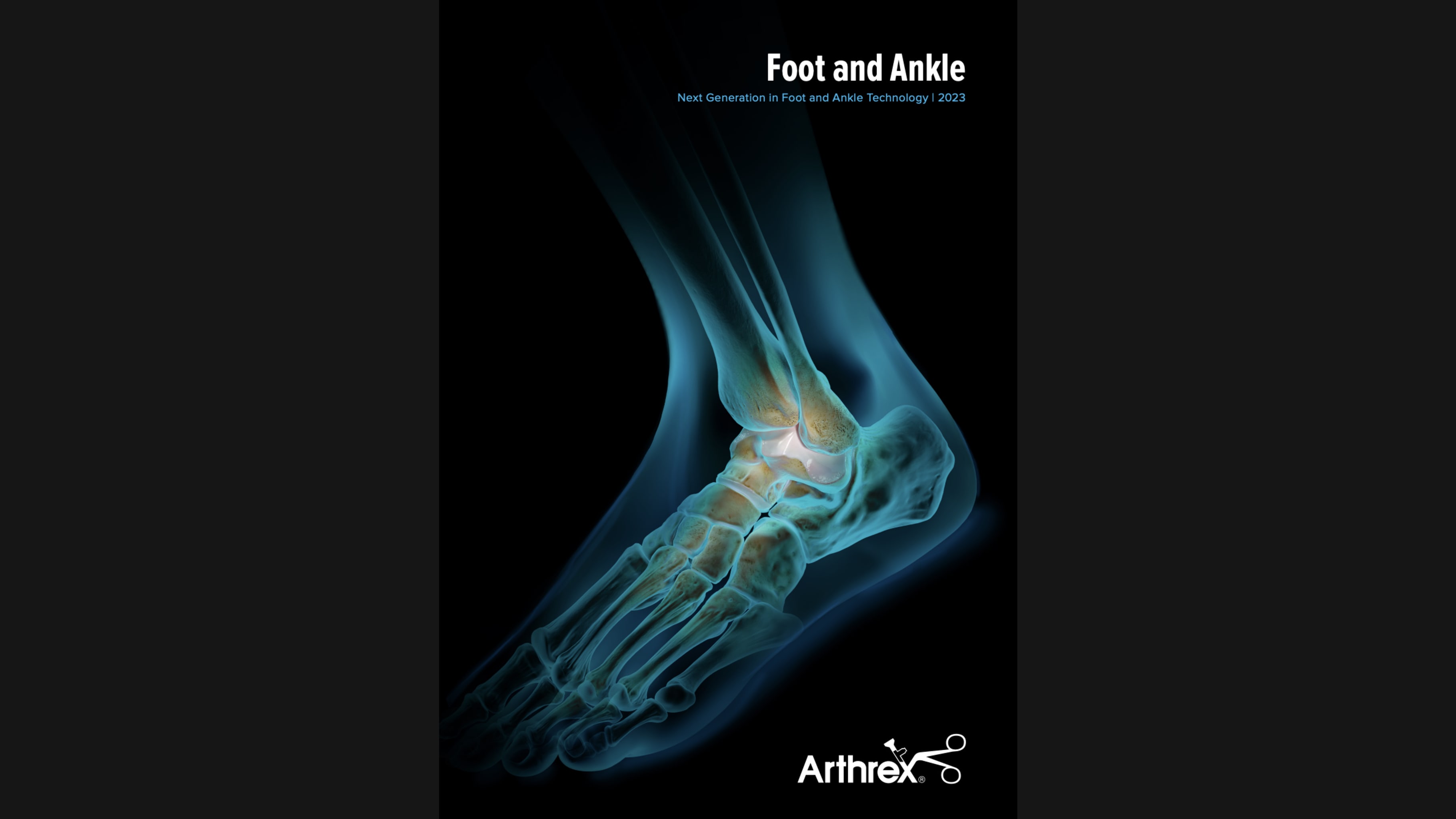 Arthrex - Ankle Distractor