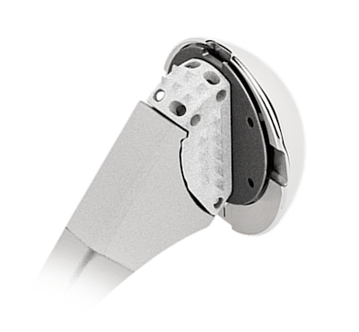 Arthrex - Arthrex ECLIPSE and UNIVERS Orientation Pin for Resection ...