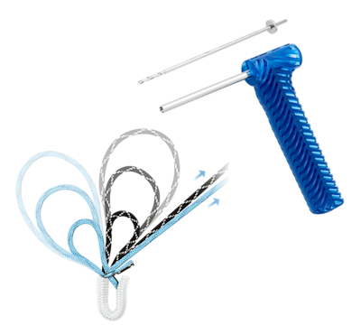Arthrex - MPFL Repair Using Knee FiberTak® Anchors and the ...