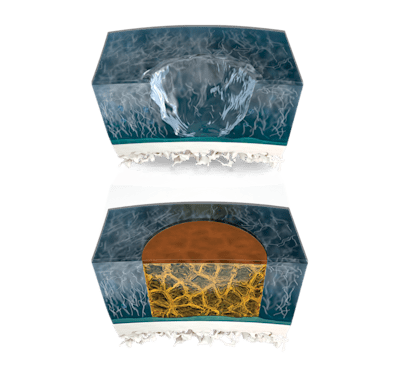 Arthrex - Joint Preservation With Cartilage Restoration Using the ...