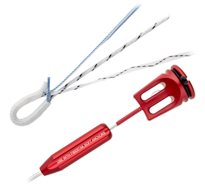 Arthrex - Knotless 1.8 FiberTak Soft Anchor, w/ #2 Suture, qty. 5 - AR-3636
