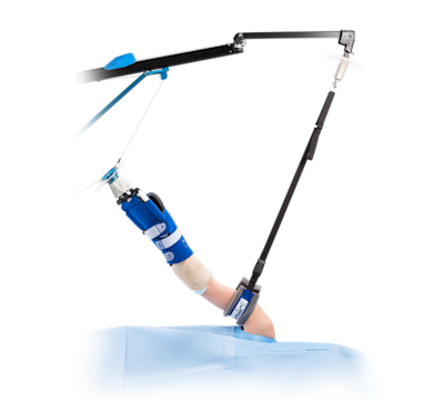 Arthrex - Lateral Positioners