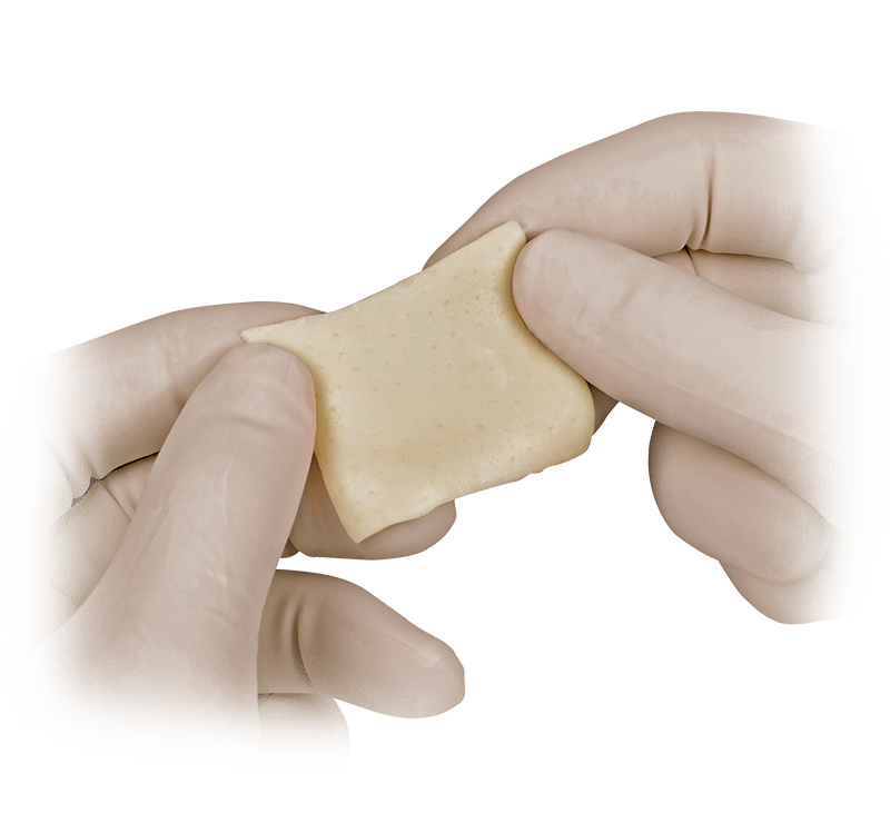 Arthrex - ArthroFLEX® Decellularized Dermal Allograft