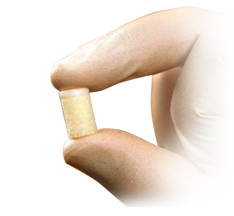 Arthrex - Backfill Plugs