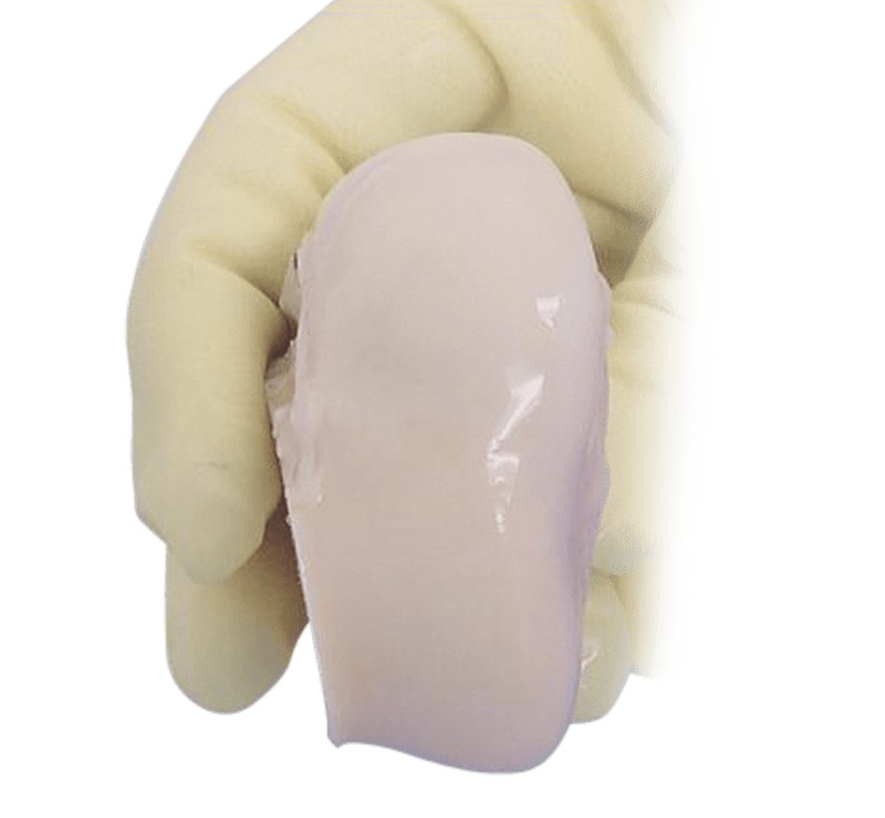 Arthrex - Fresh Cartilage