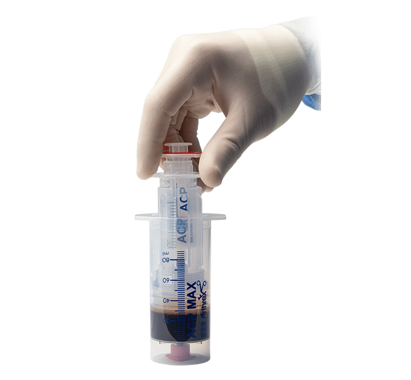 Arthrex - ACP Max™ PRP System