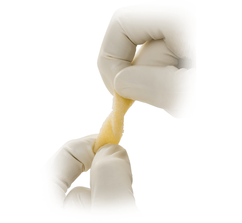 Arthrex - AlloSync™ Bone Grafts