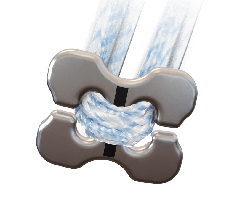 Arthrex - Dog Bone™ Button