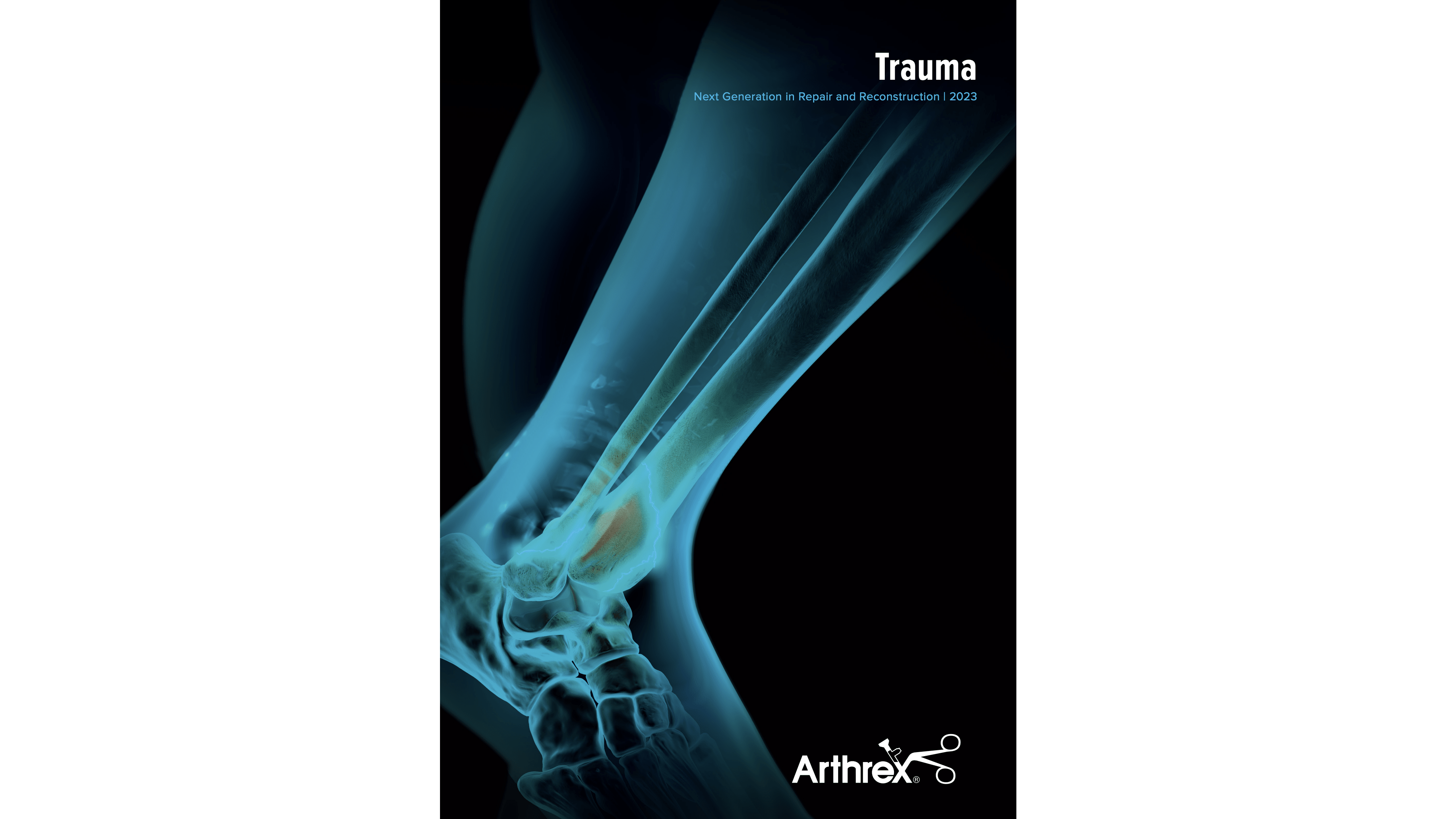 Arthrex - Ankle Fracture System™ aus Titan