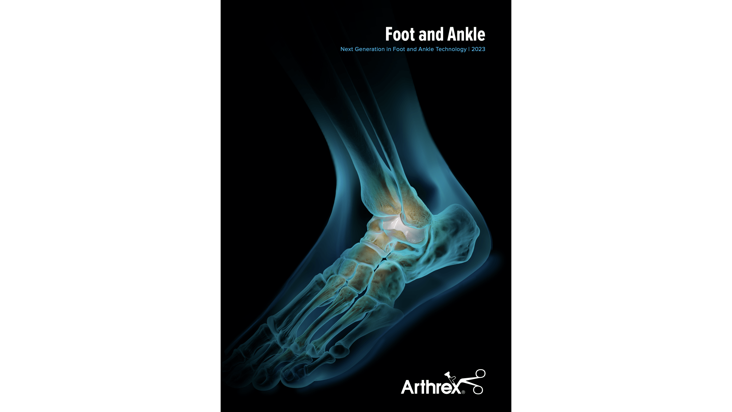Arthrex - Ankle Fracture System™ aus Titan