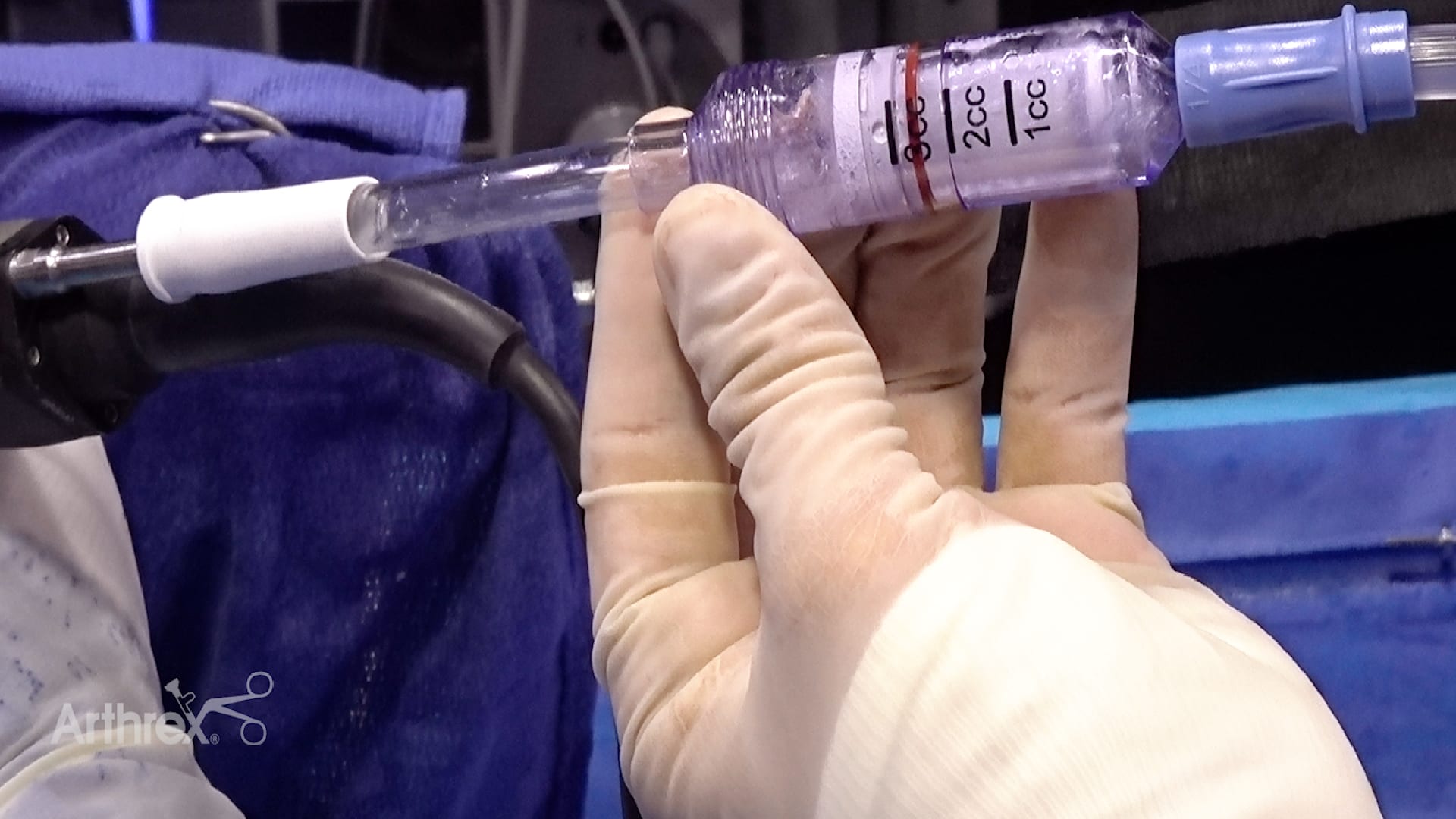 Arthrex - AutoCart™ Procedure for Cartilage Lesions in the Hip