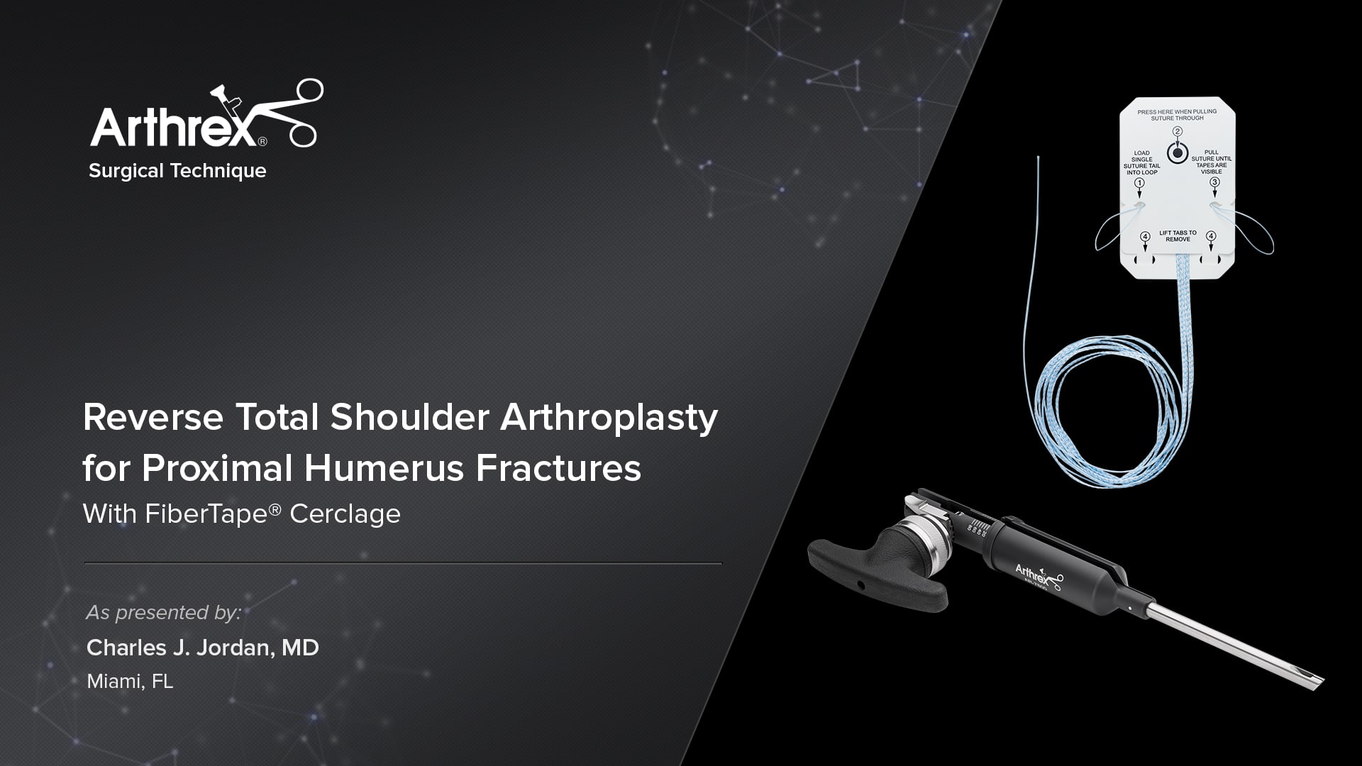 Arthrex - Reverse Total Shoulder Arthroplasty With FiberTape® Cerclage ...