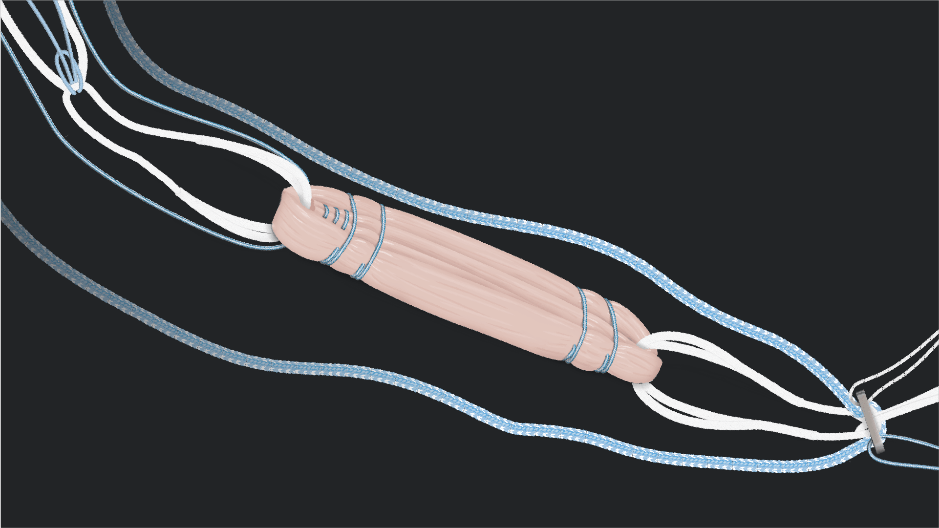 Arthrex - TightRope® II RT Implant