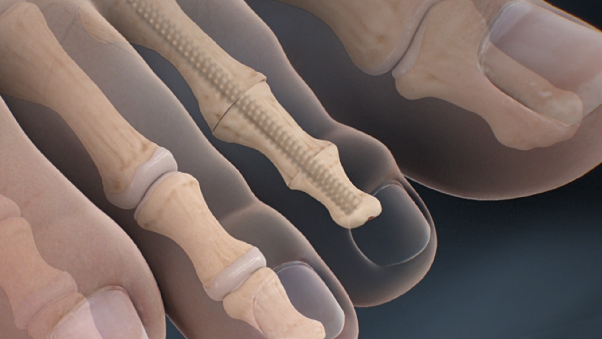 Arthrex - Minimally Invasive Surgery