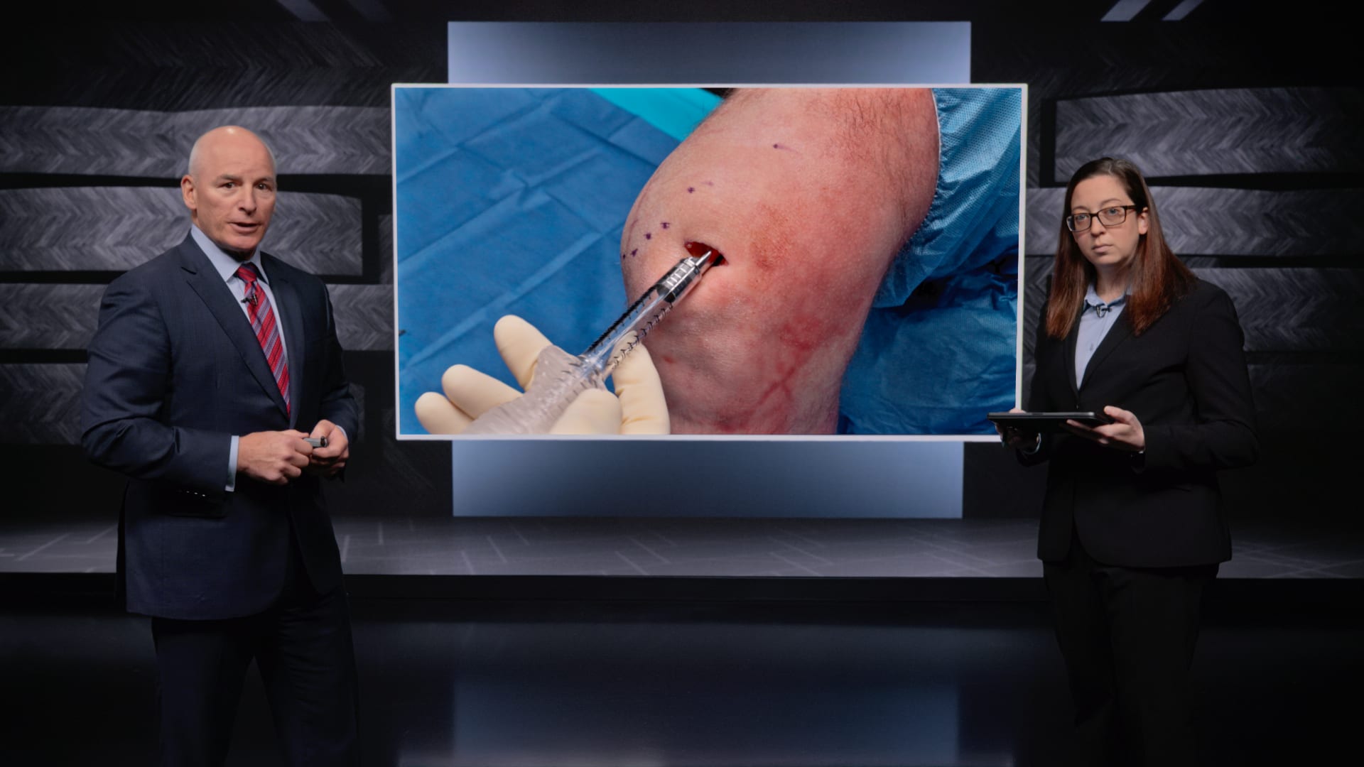 Arthrex - BreakThrough™ With Christopher Adams—Quad ACL Episode 2 ...