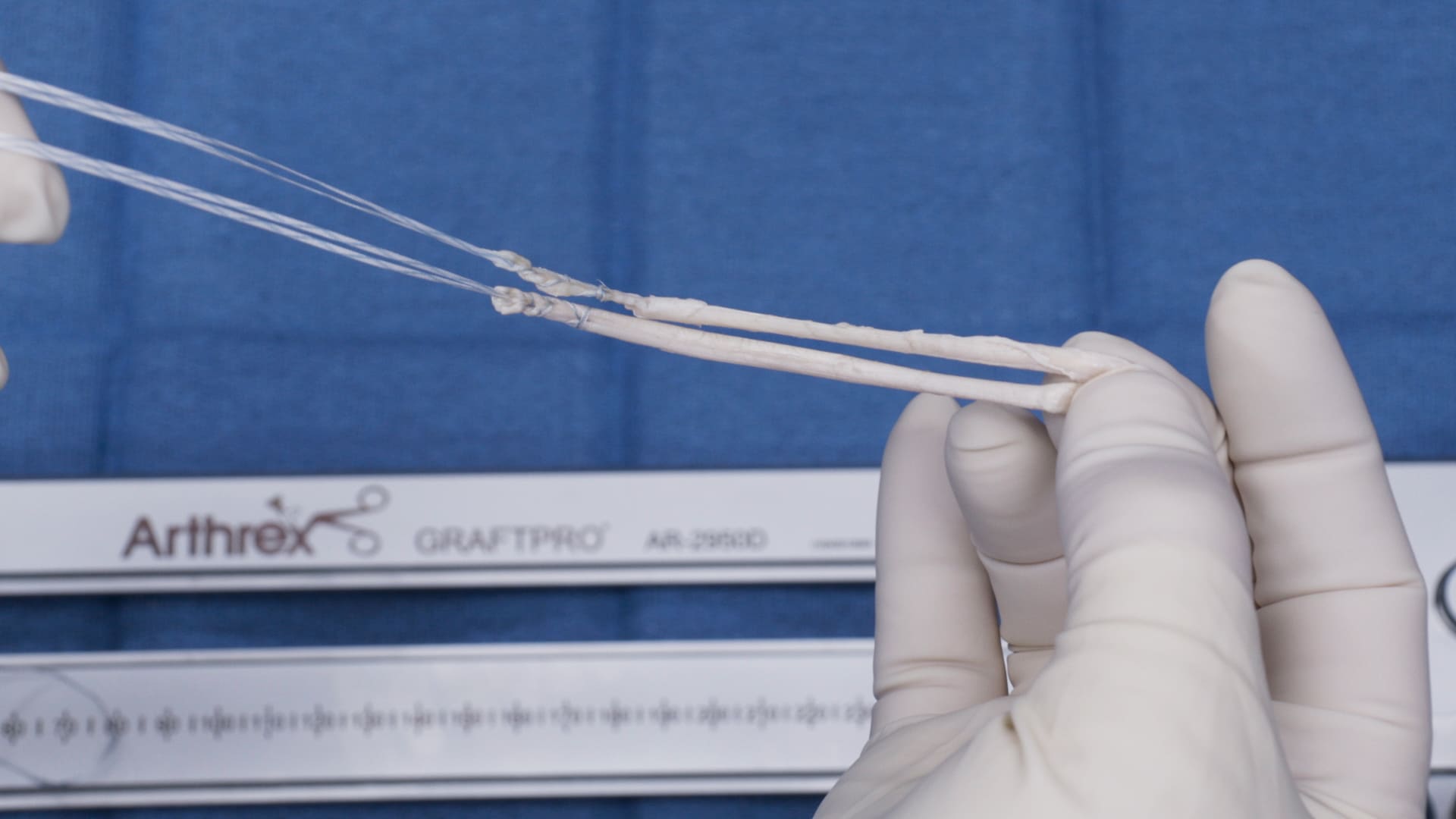 Arthrex - MPFL Graft Preparation Using FiberLoop® SutureTape