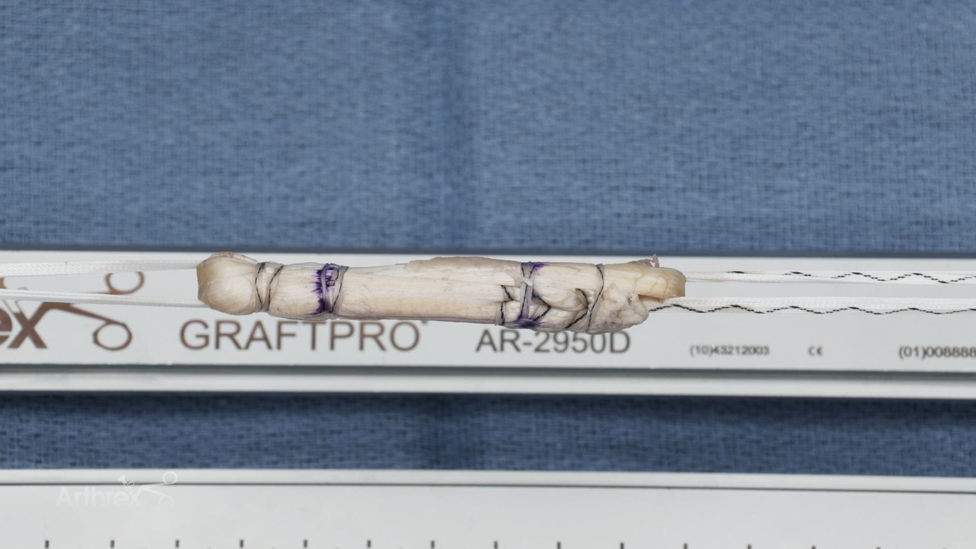 Arthrex Graft Preparation Using The Graftlink® Technique With The Acl Tightrope® Ii Implant