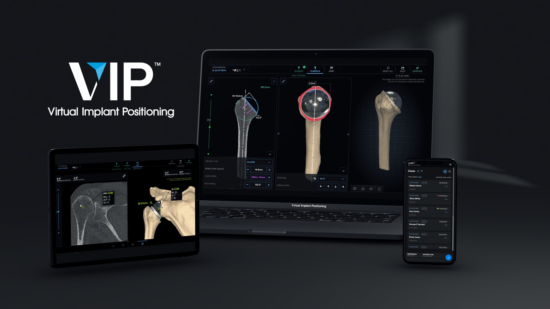 Arthrex - Now Available in the VIP™ Preoperative Planning System ...