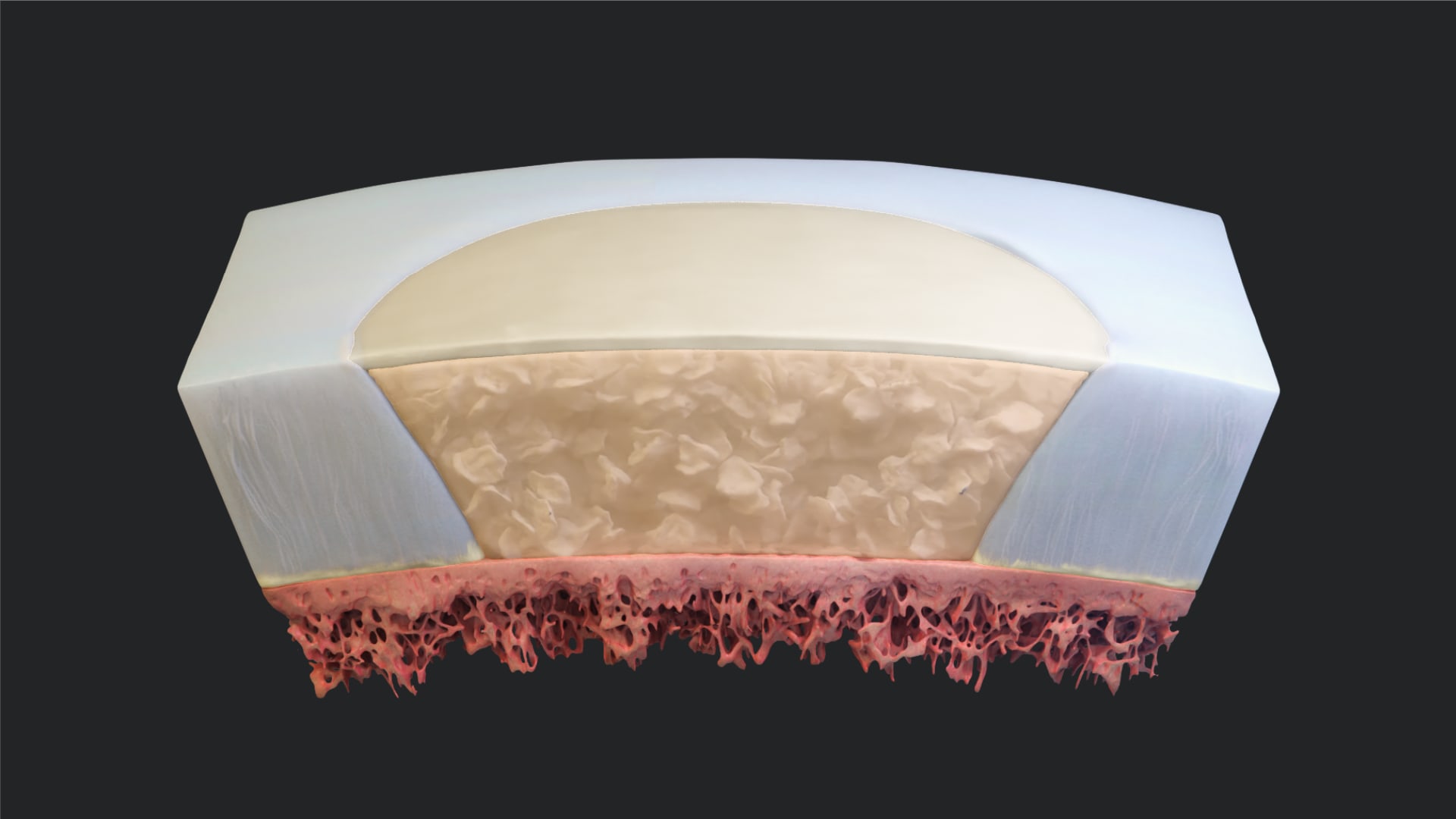 Arthrex - Treatment of a Symptomatic Patellar Cartilage Defect Using ...