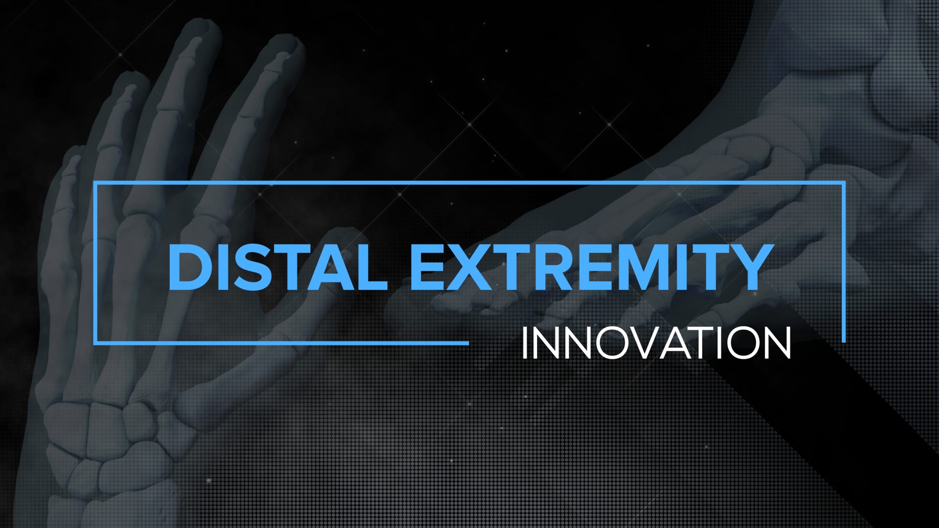 Arthrex - Distal Extremity Innovation
