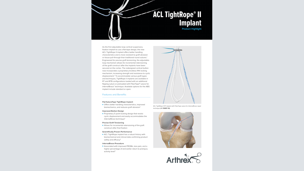 Arthrex - ACL TightRope® II Implant