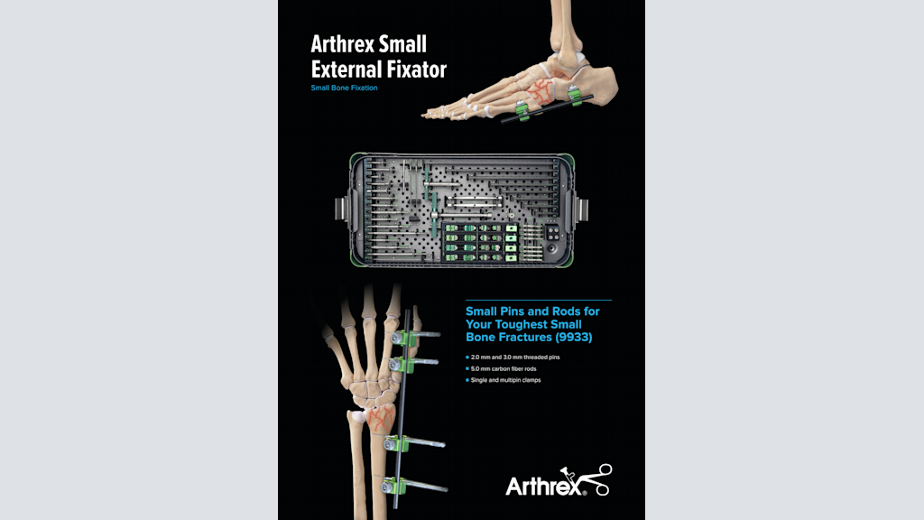 Arthrex - Small External Fixator