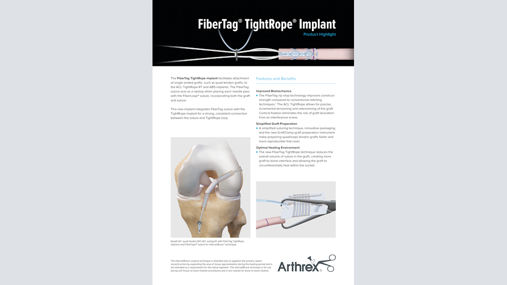 Arthrex - FiberTag® TightRope® Implant