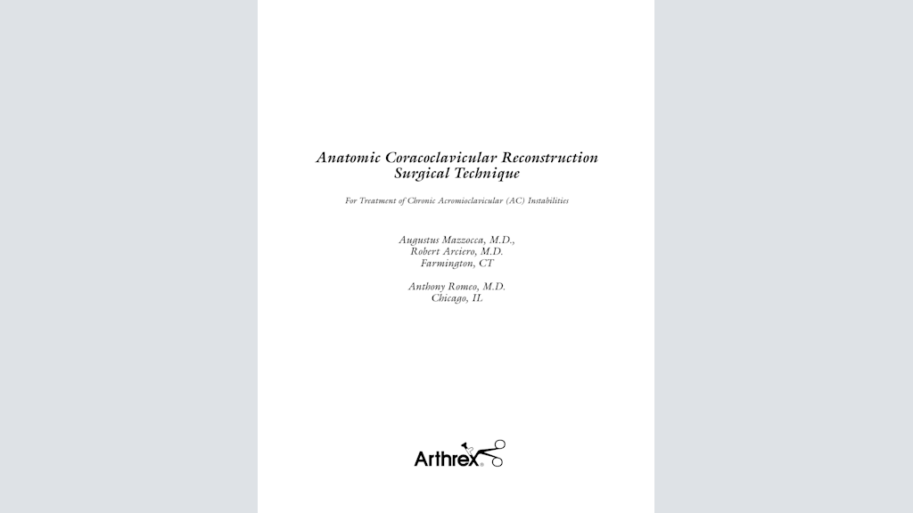 Arthrex - Chronic AC Joint Reconstruction Technique