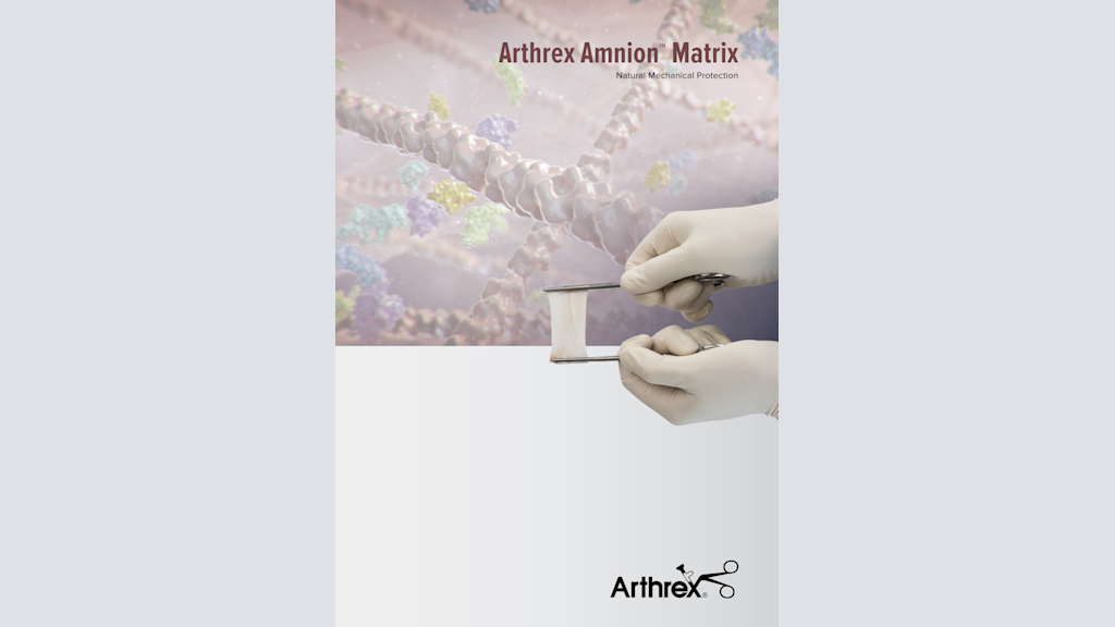 Arthrex - Arthrex Amnion™ Matrix