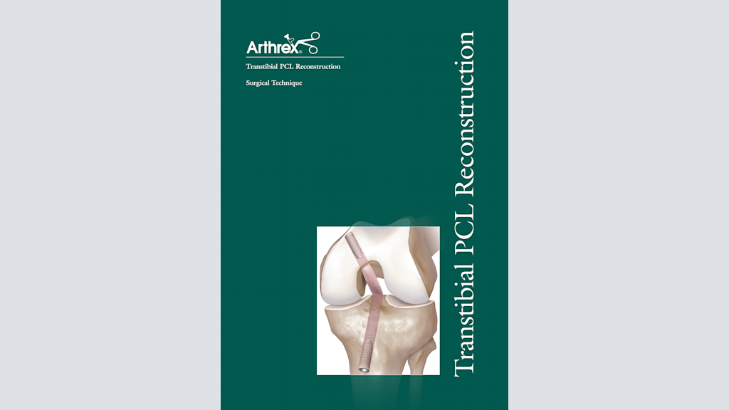 Arthrex - Posterior Cruciate Ligament (PCL) Reconstruction